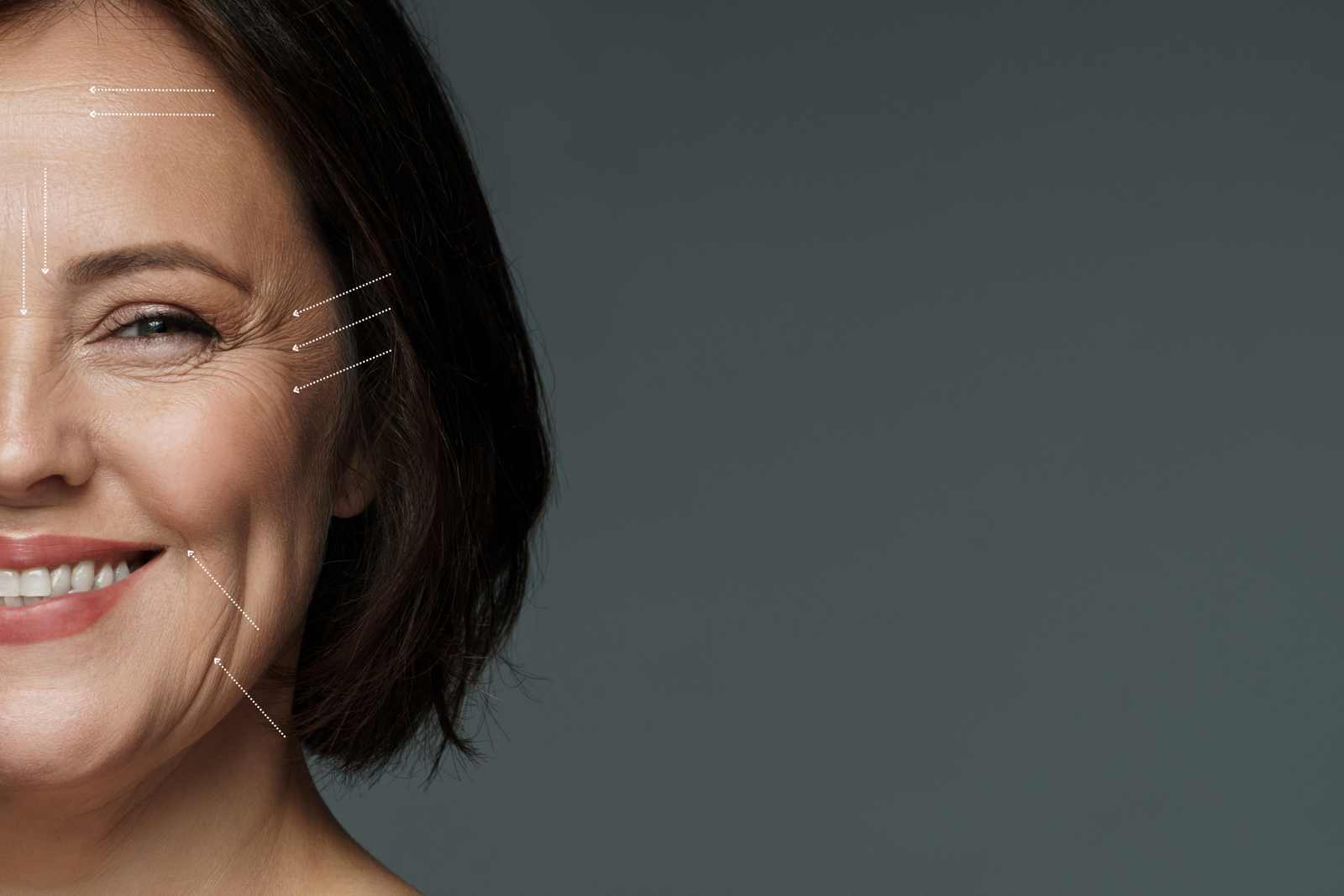 Neuromodulators - Botox, Dysport, and Daxxify